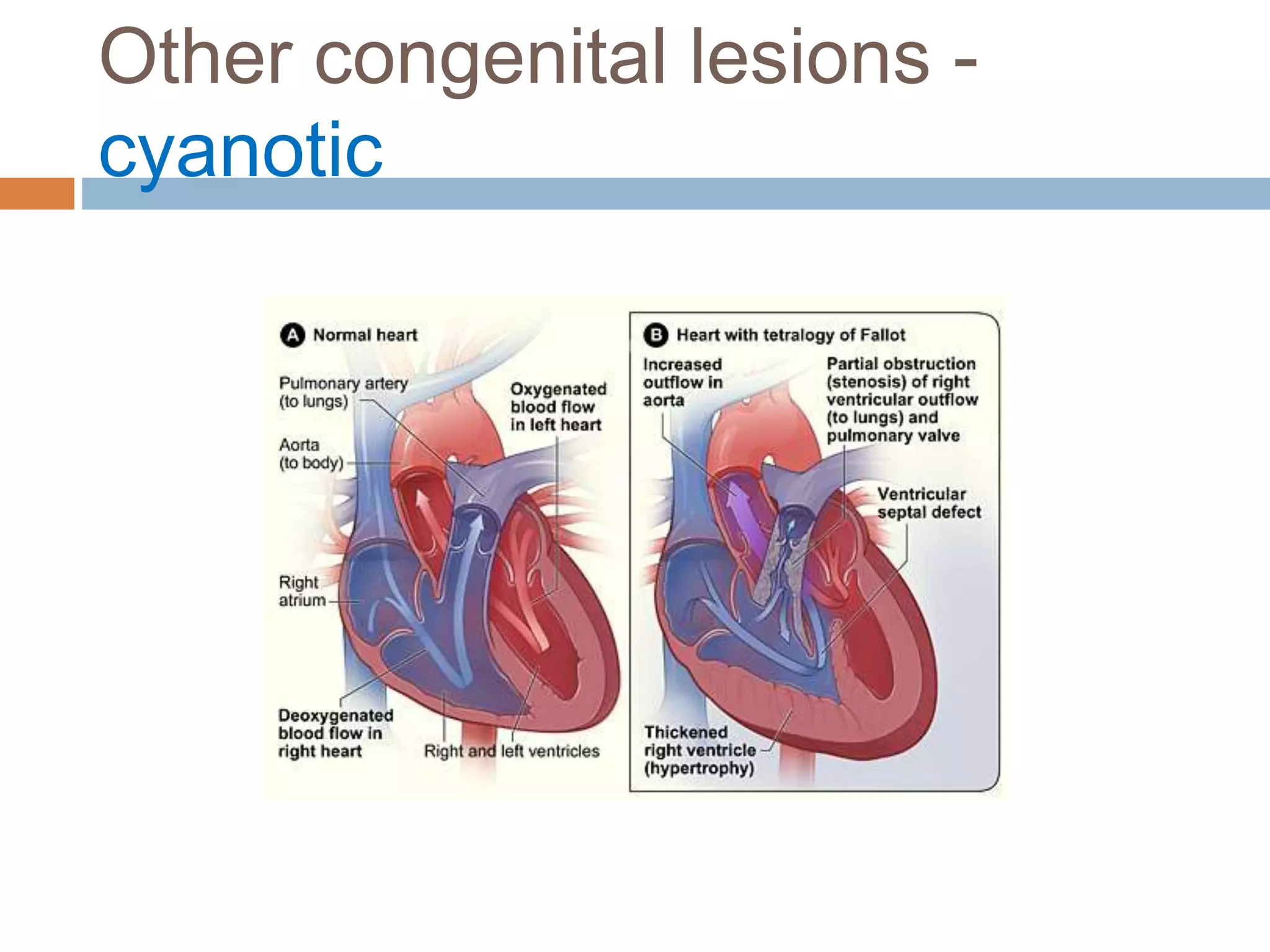 congenital-diseases.pptx