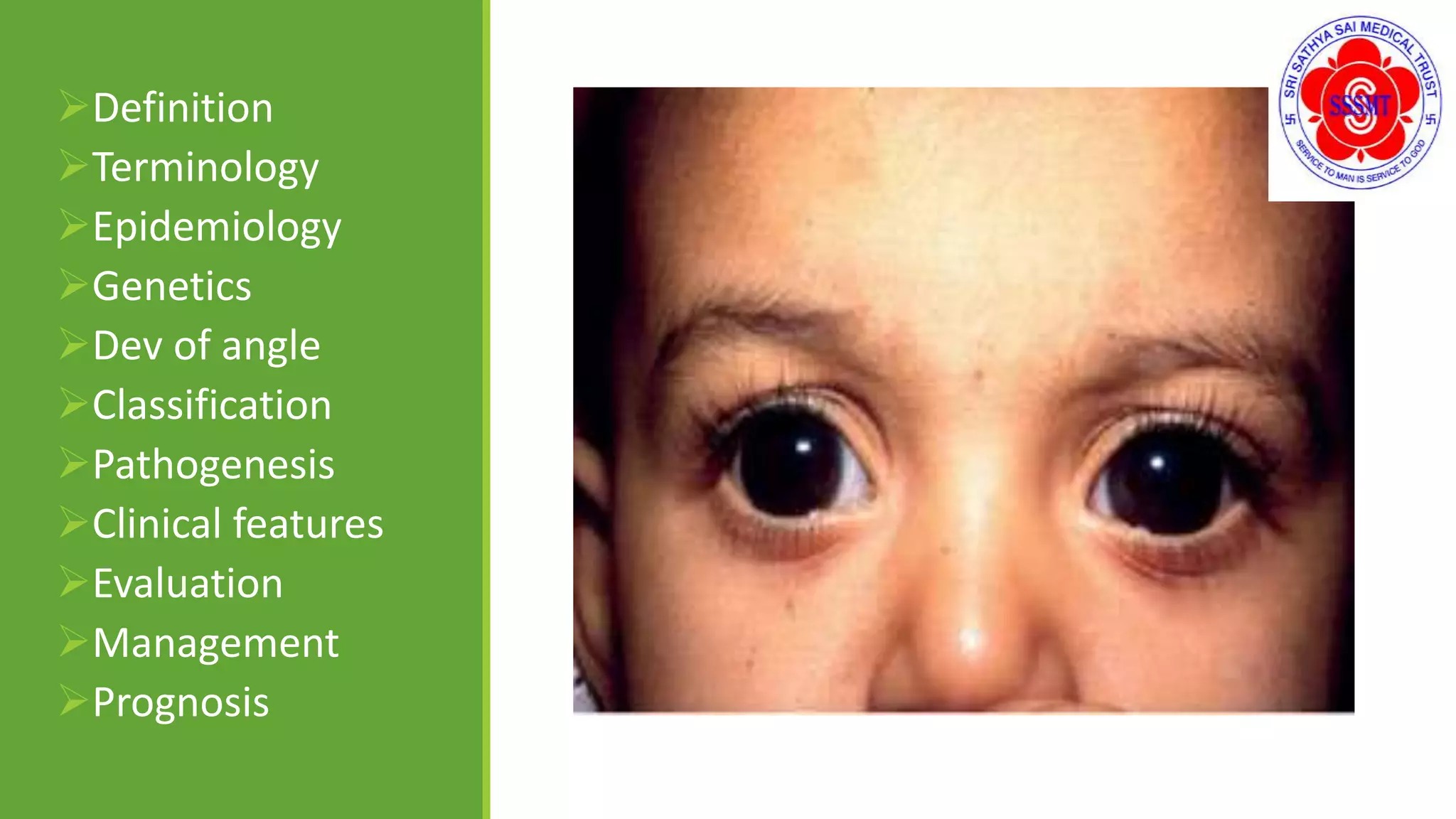 Congenital glaucomas | PPTX