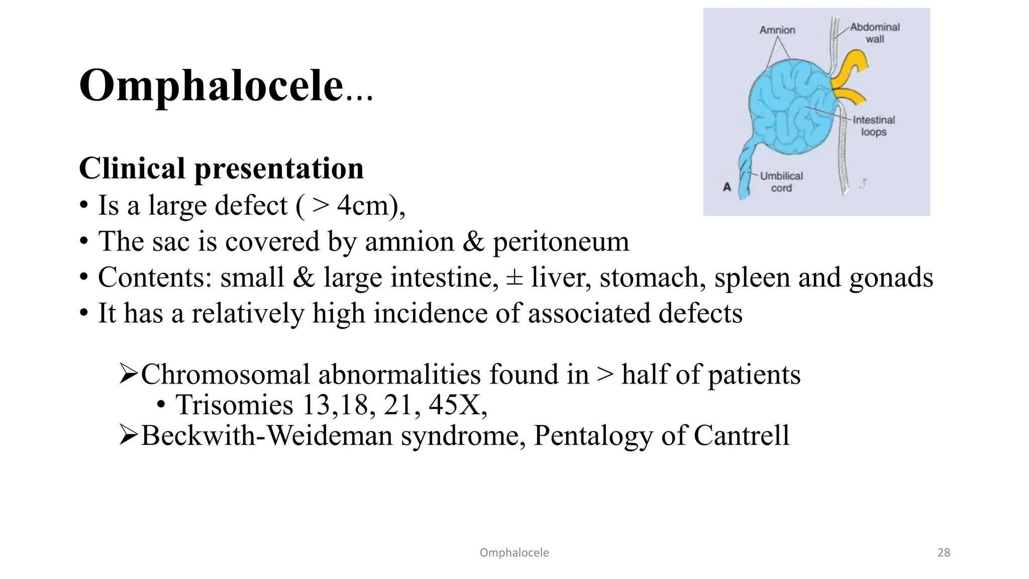 Approach to Congenital abdominal wall defects .pptx