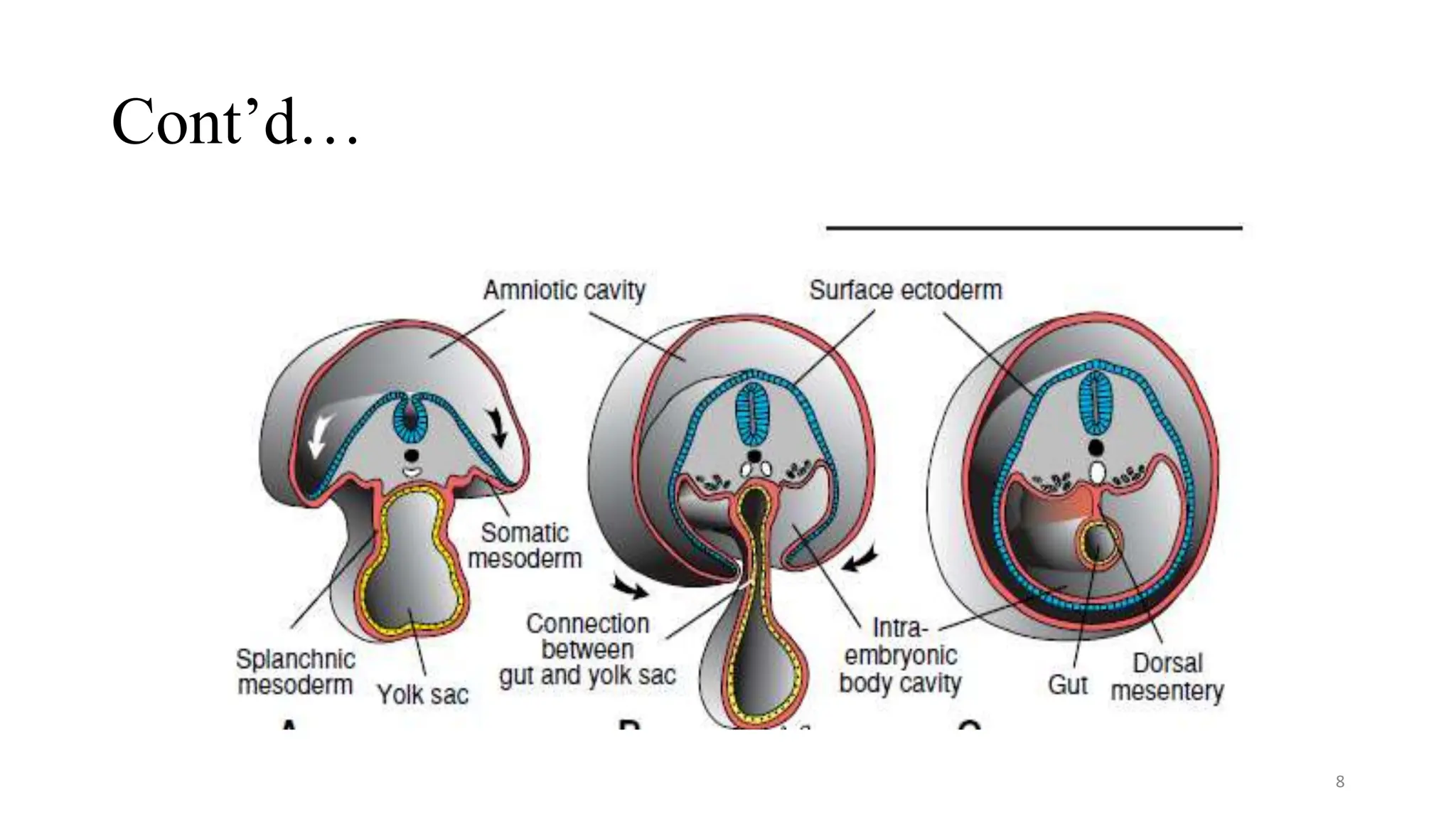 Approach to Congenital abdominal wall defects .pptx