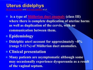 Congenital abnormaleties of the uterus | PPTX