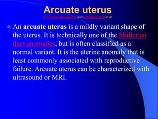 Congenital abnormaleties of the uterus | PPTX