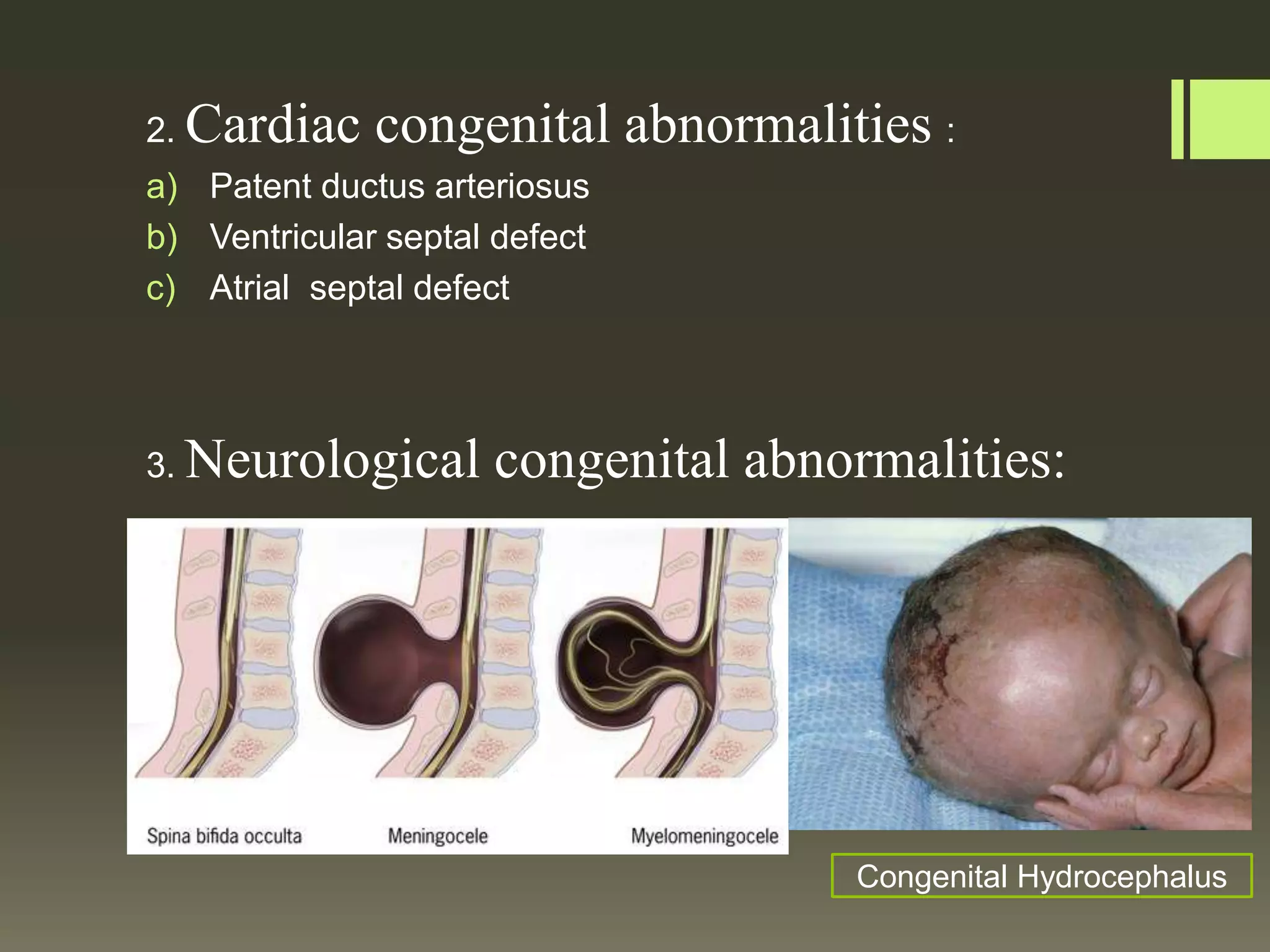 Congenital Abnormalities | PPTX