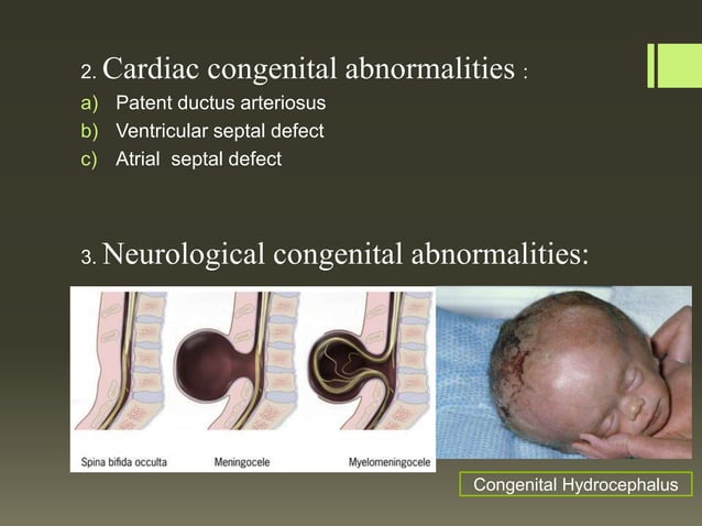 Congenital Abnormalities | PPTX