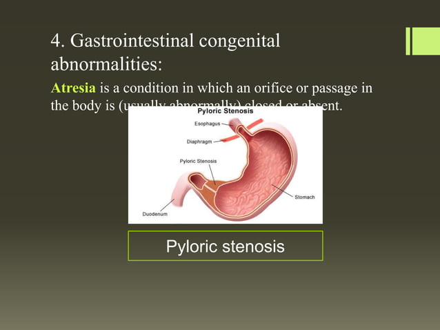 Congenital Abnormalities | PPTX
