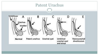 congenital abnormalities.pptx