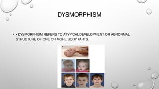 Congenital abnormalities and diagnostic approaches | PPTX