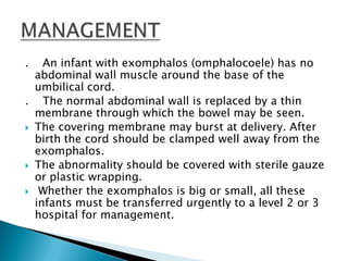 Congenital abnormalities by Erum Khowaja | PPTX