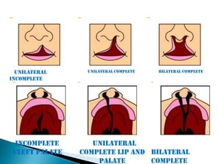 Congenital abnormalities by Erum Khowaja | PPTX