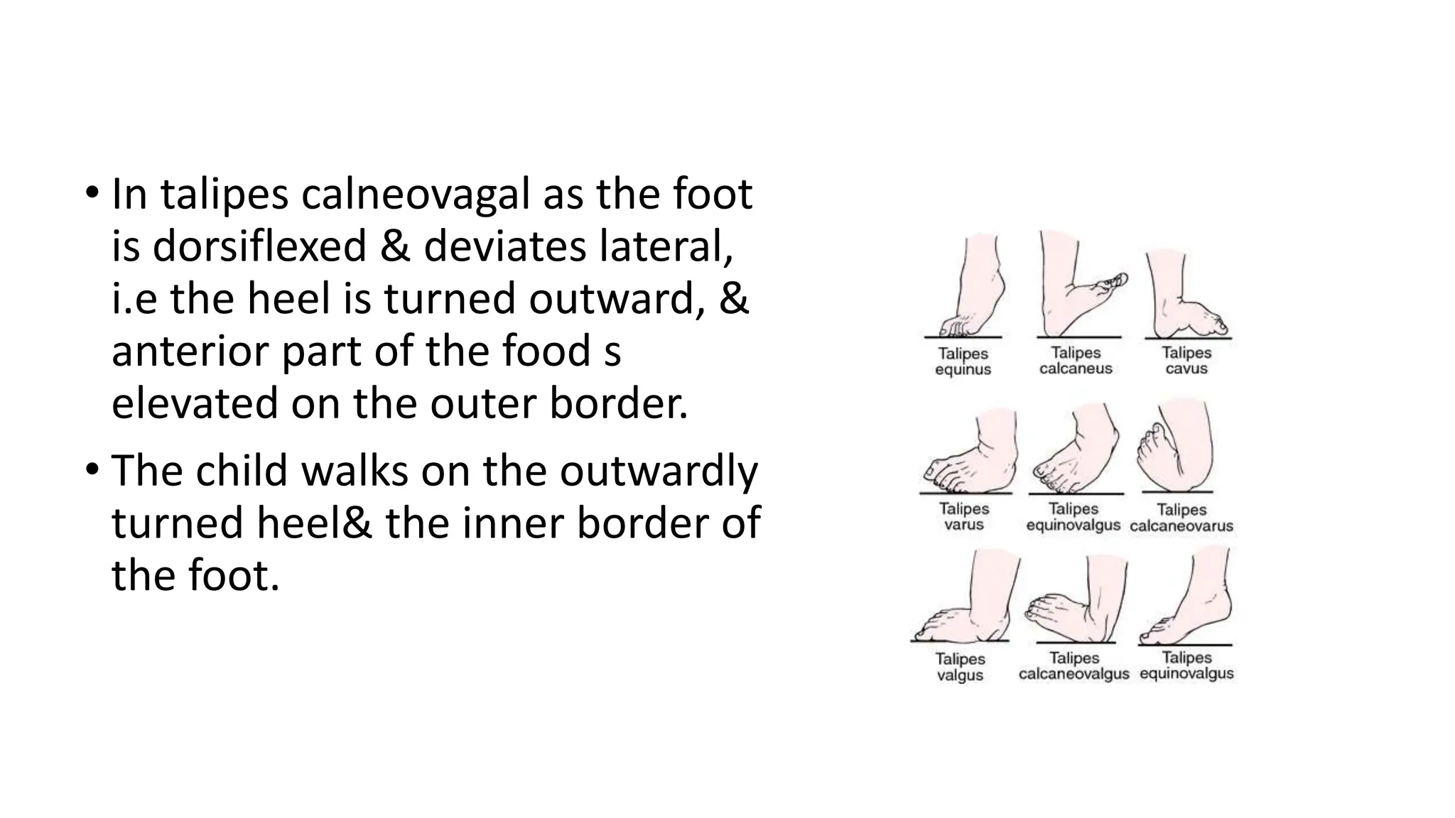CONGENITAL ABNOR NEWBORNS & INFANTS.pptx