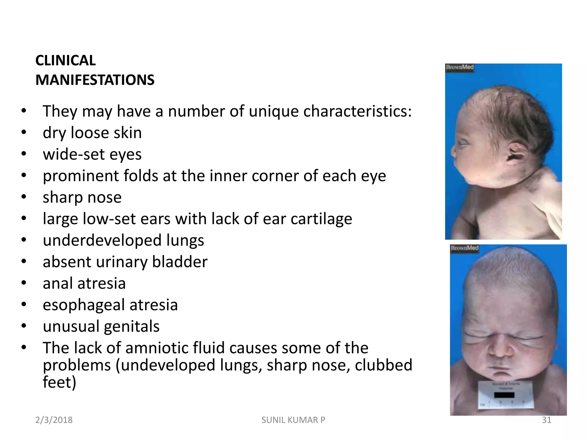 Congenital abnormalities of kidney and urinary system | PPTX