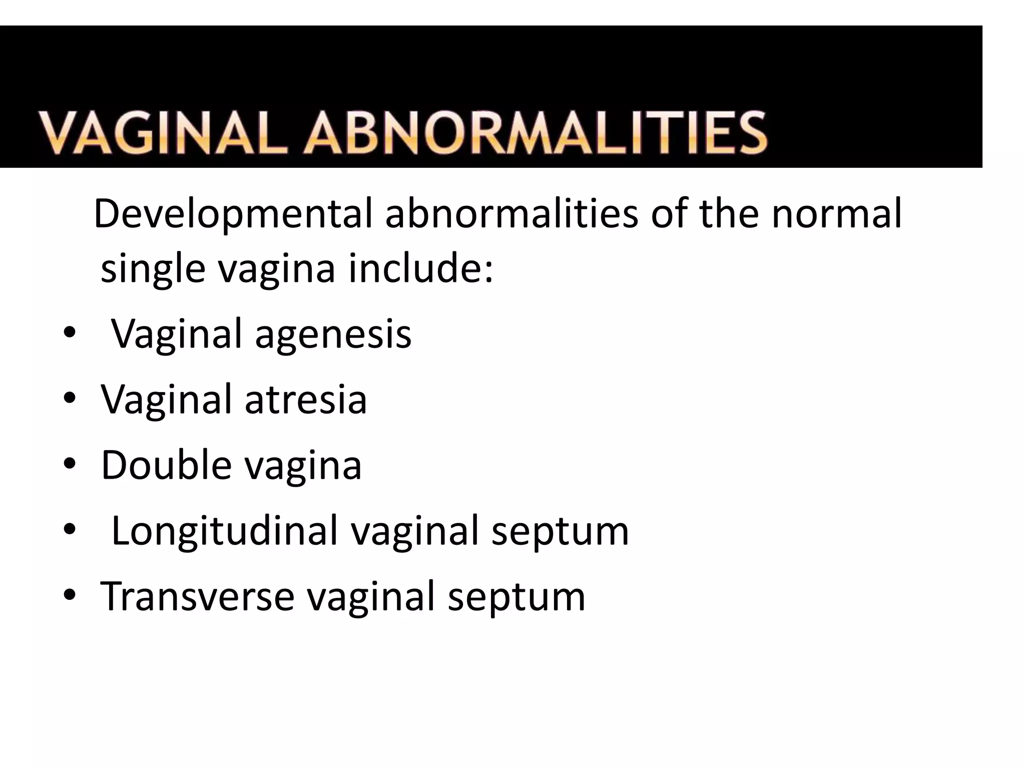 Congenital abnormalities of reproductive system | PPTX
