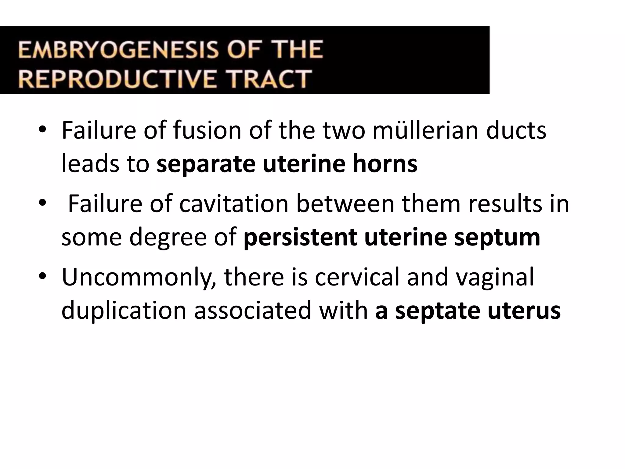 Congenital abnormalities of reproductive system | PPTX