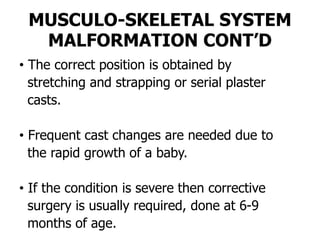 CONGENITAL ABNORMALITIES OR (1) - Copy.pptx