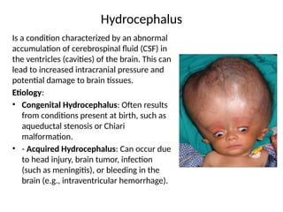 Congenital abnormality of nervohggggus system.pptx