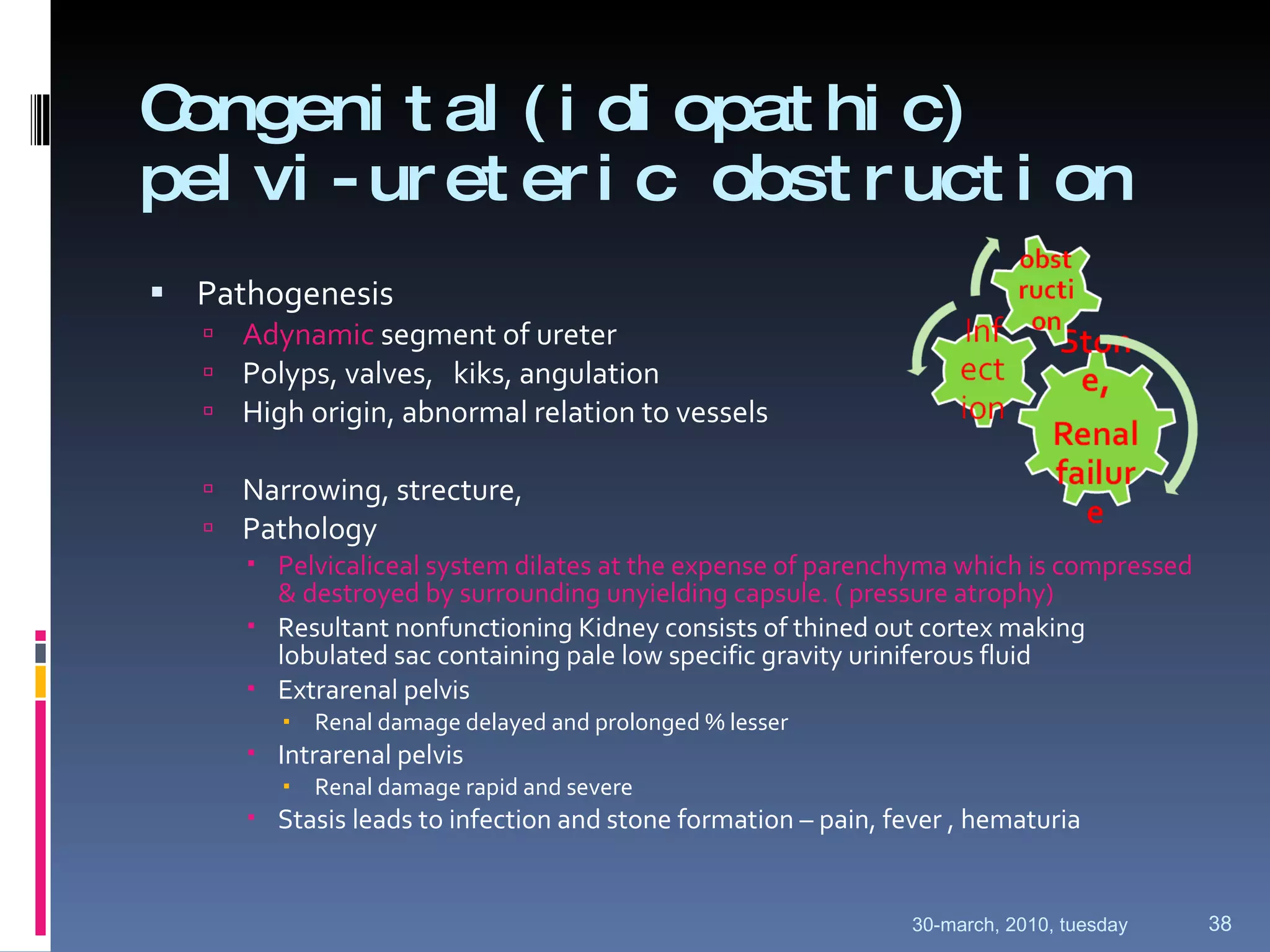 Congenital abnormities of kidney ad ureter 30 3-10 | PPT | Reproductive ...