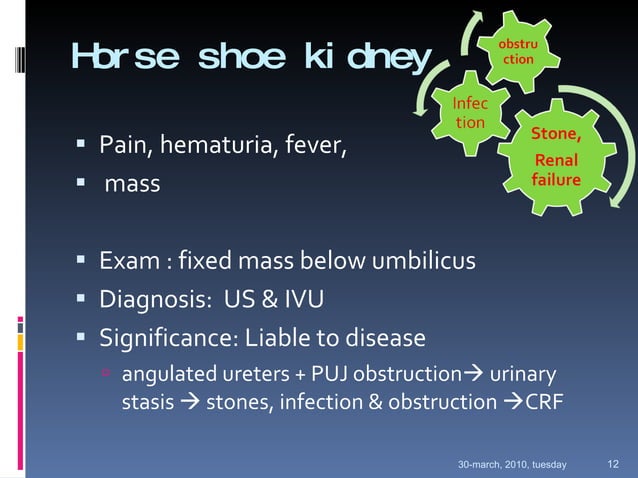 Congenital abnormities of kidney ad ureter 30 3-10 | PPT | Reproductive ...
