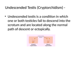 Congenital abrnomalities of Urogenital of System | PPTX