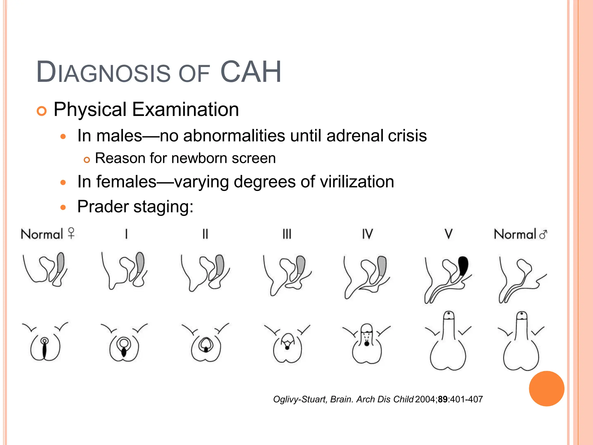 Congenital_Adrenal_Hyperplasia.pptx