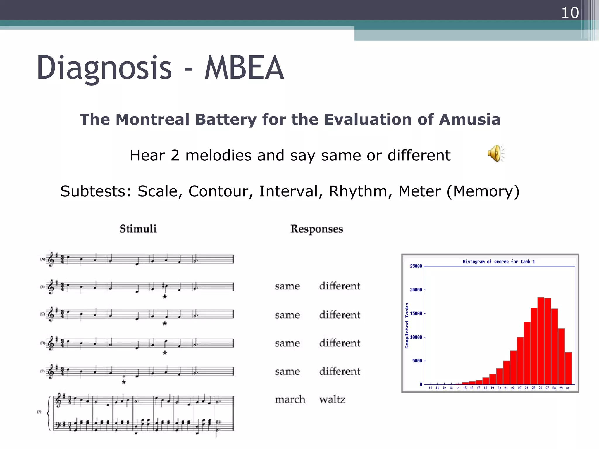Congenital amusia york 2012 | PPT