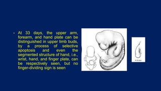 Hand CONGENITAL ANAMOLIES classification.pptx