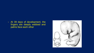 Hand CONGENITAL ANAMOLIES classification.pptx