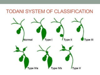Congenital anamolies and applied anatomy of biliary tree | PPTX ...