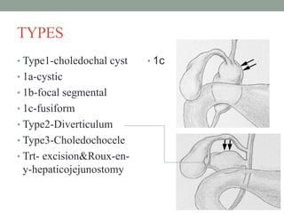 Congenital anamolies and applied anatomy of biliary tree | PPTX