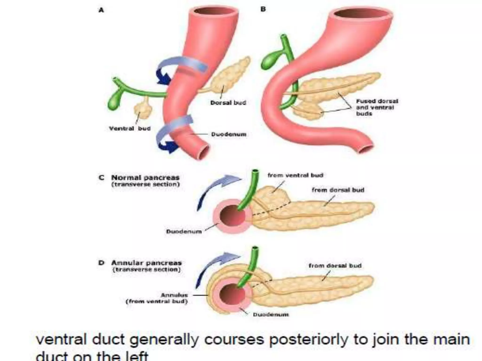 Congenital anamolies of pancrease | PPTX