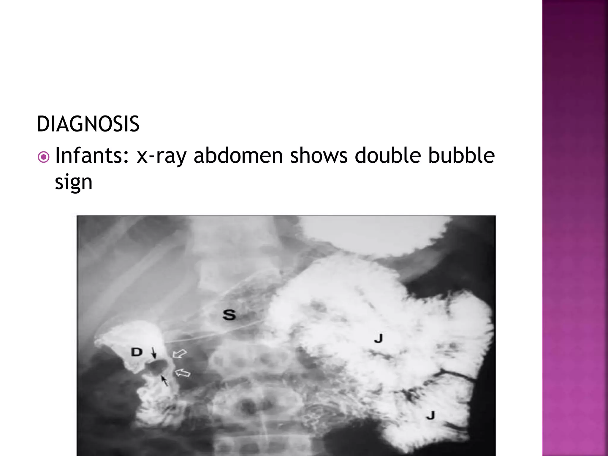 Congenital anamolies of pancrease | PPTX
