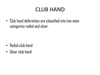 Congenital anamolies upper limb - Dr.KK