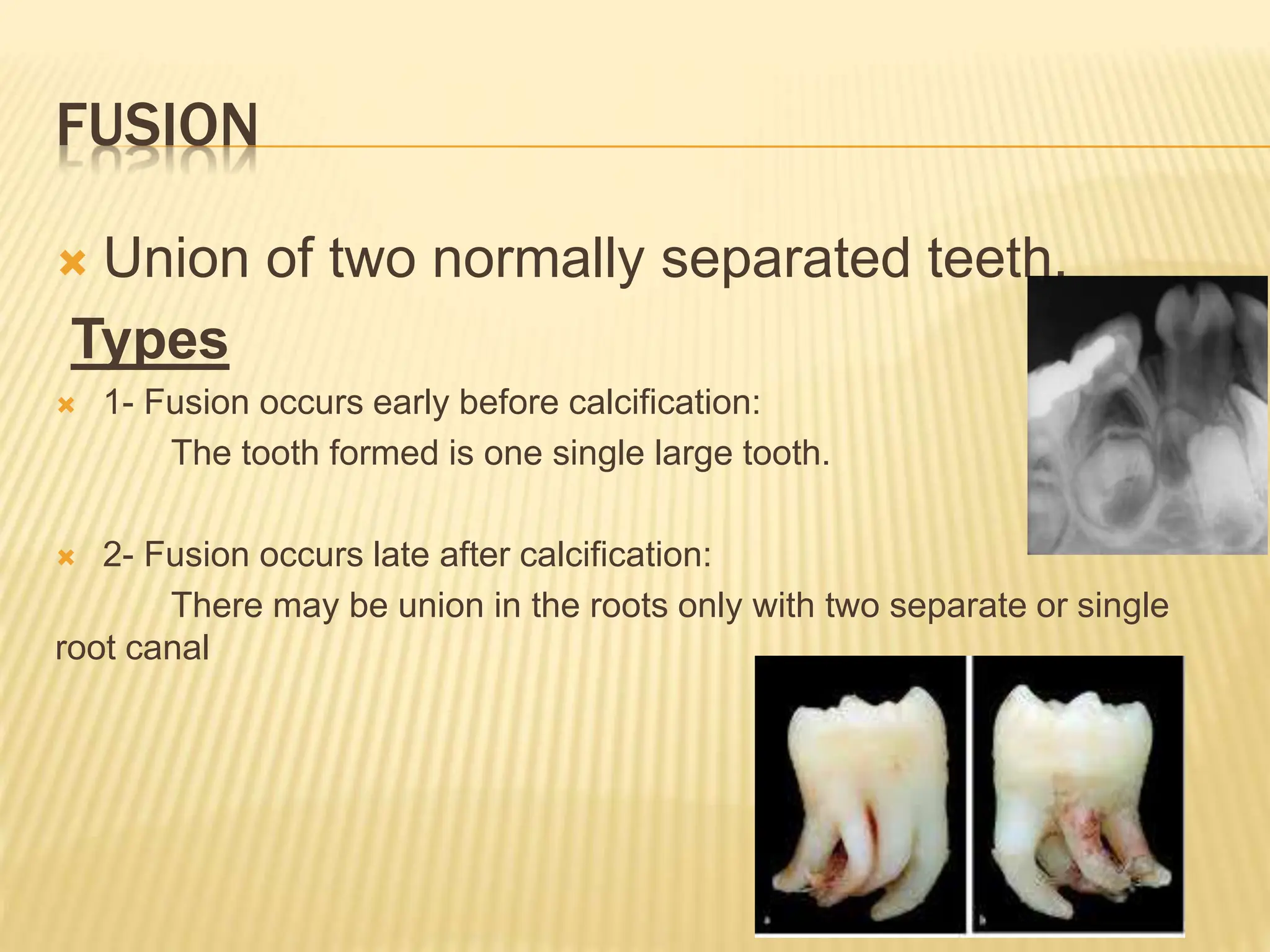 CONGENITAL AND DEVELOPMENTAL DEFECTS OF TEETH.pptx