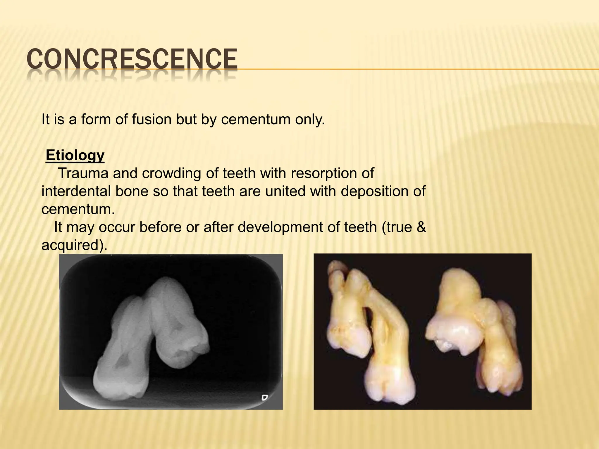 CONGENITAL AND DEVELOPMENTAL DEFECTS OF TEETH.pptx