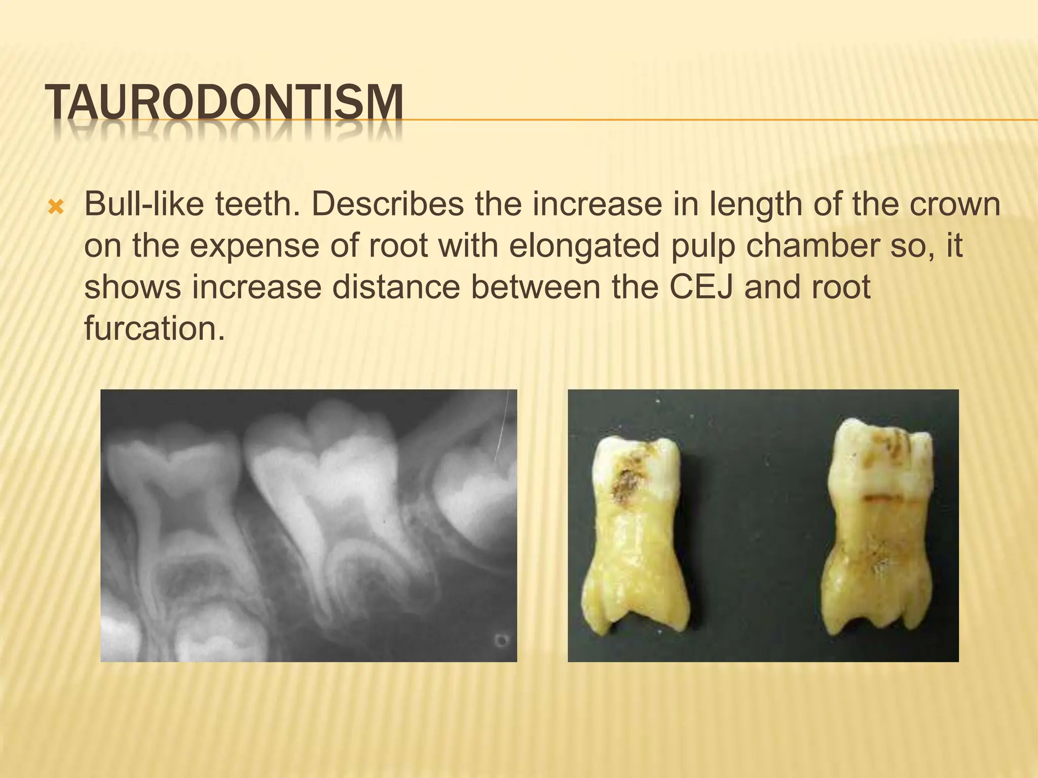 CONGENITAL AND DEVELOPMENTAL DEFECTS OF TEETH.pptx
