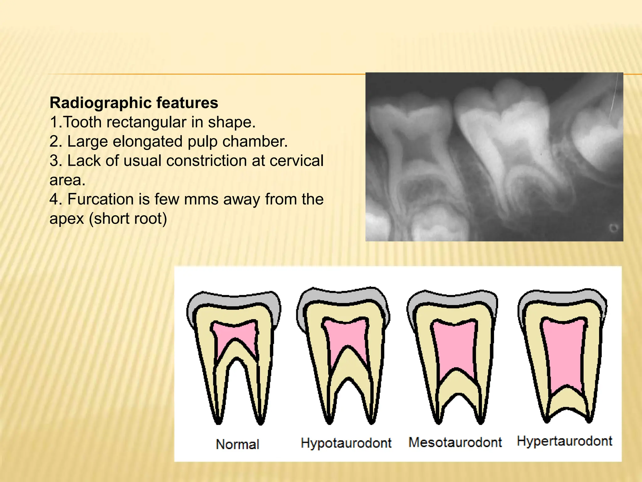 CONGENITAL AND DEVELOPMENTAL DEFECTS OF TEETH.pptx