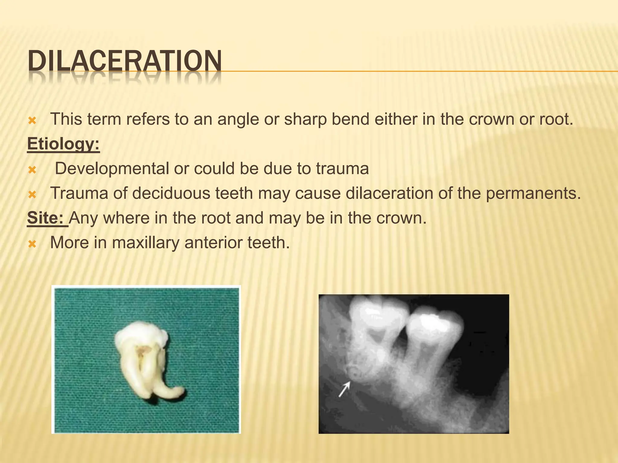 CONGENITAL AND DEVELOPMENTAL DEFECTS OF TEETH.pptx