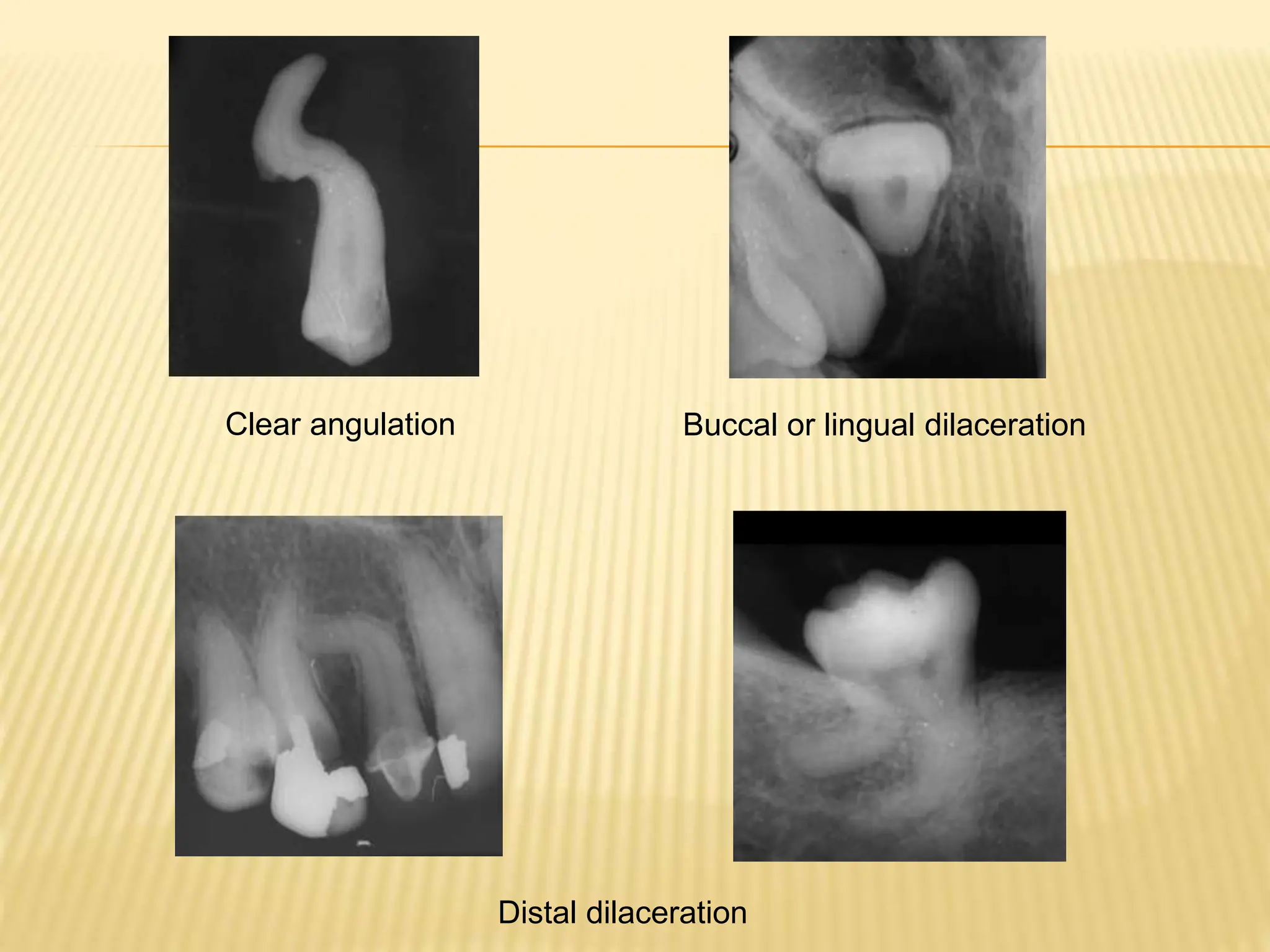 CONGENITAL AND DEVELOPMENTAL DEFECTS OF TEETH.pptx