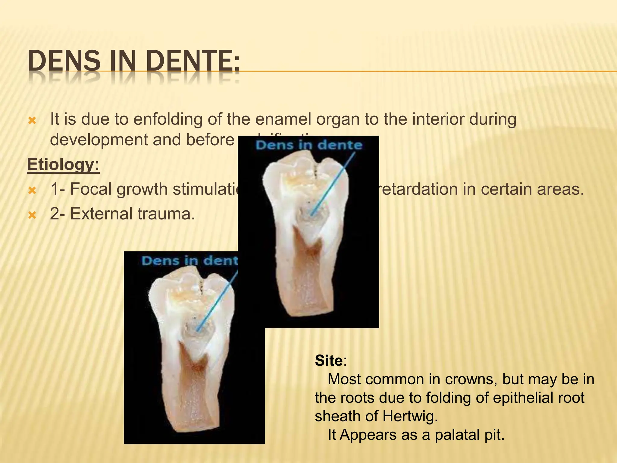 CONGENITAL AND DEVELOPMENTAL DEFECTS OF TEETH.pptx