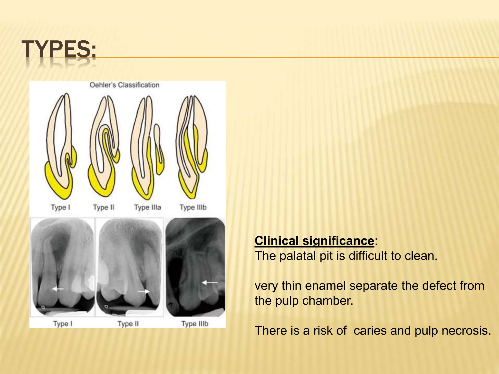 CONGENITAL AND DEVELOPMENTAL DEFECTS OF TEETH.pptx