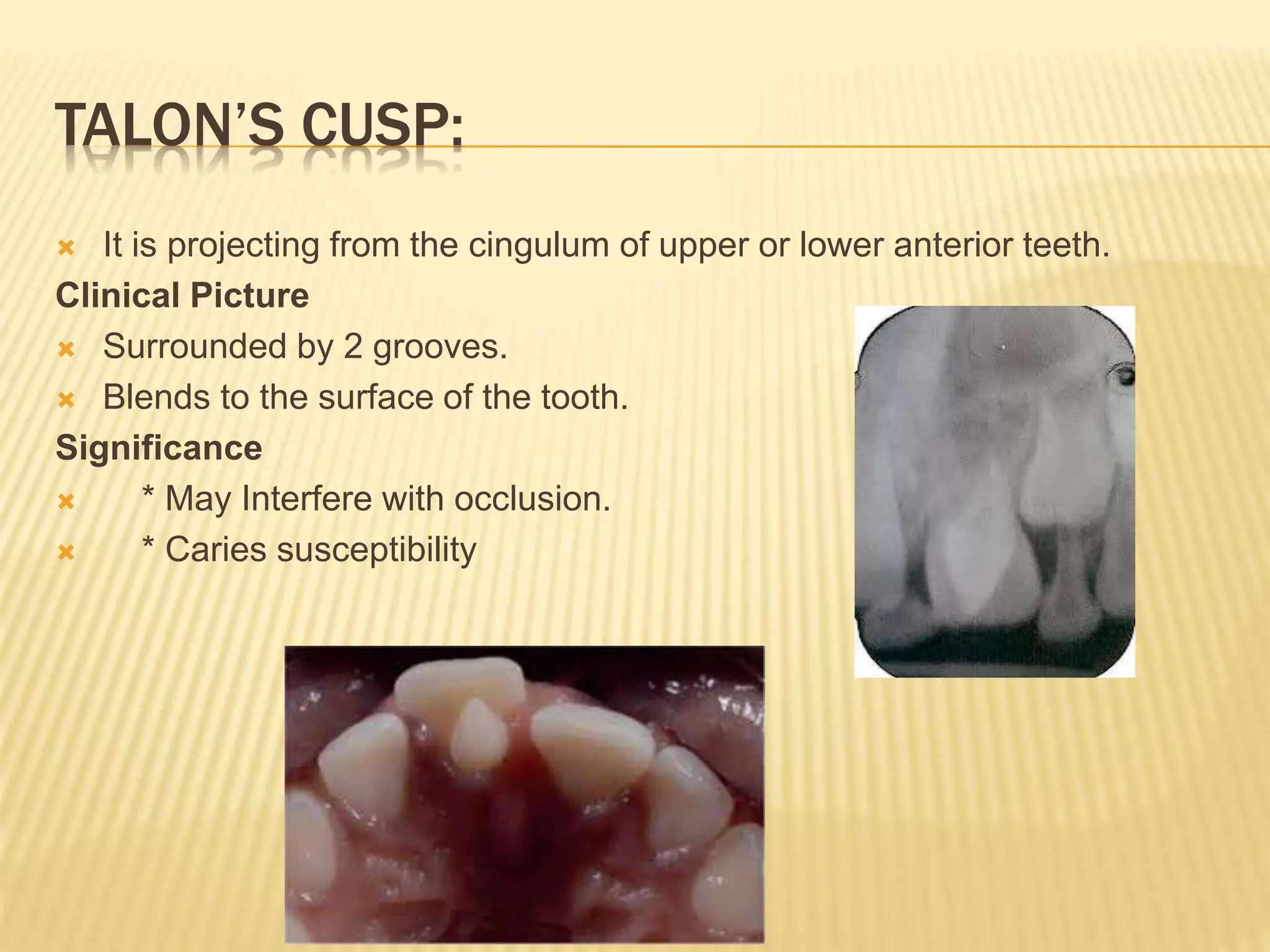 CONGENITAL AND DEVELOPMENTAL DEFECTS OF TEETH.pptx
