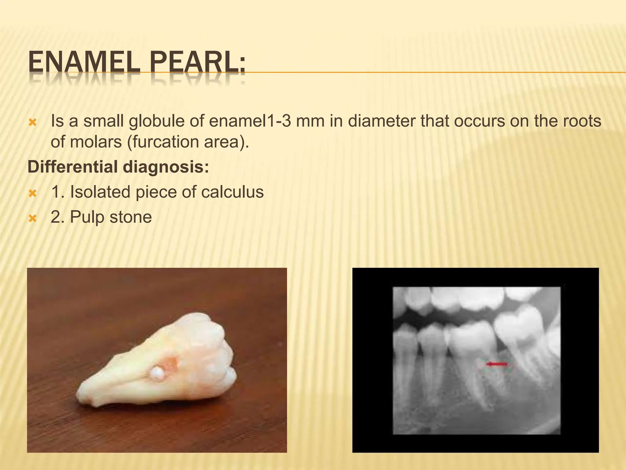 CONGENITAL AND DEVELOPMENTAL DEFECTS OF TEETH.pptx
