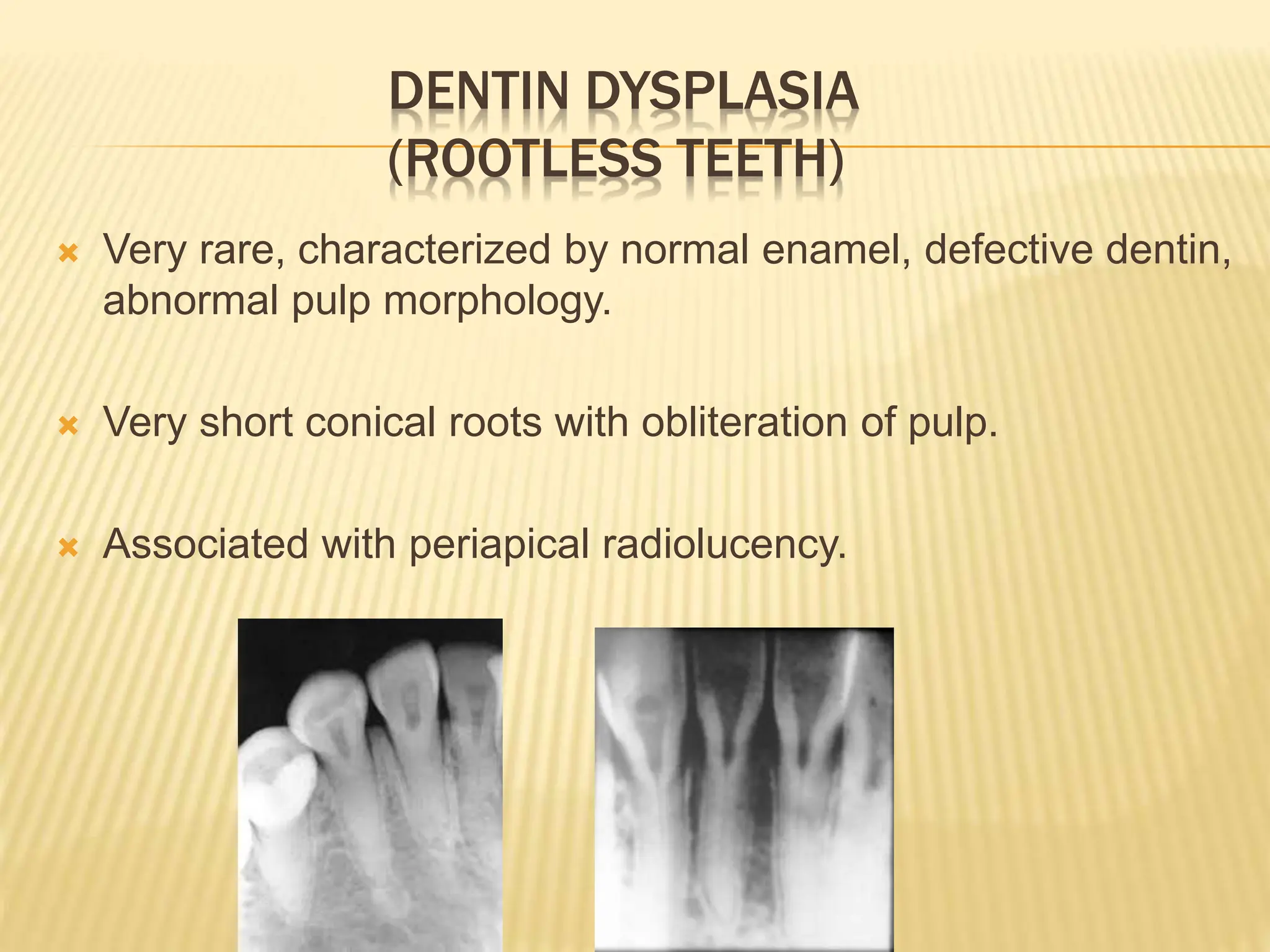 CONGENITAL AND DEVELOPMENTAL DEFECTS OF TEETH.pptx