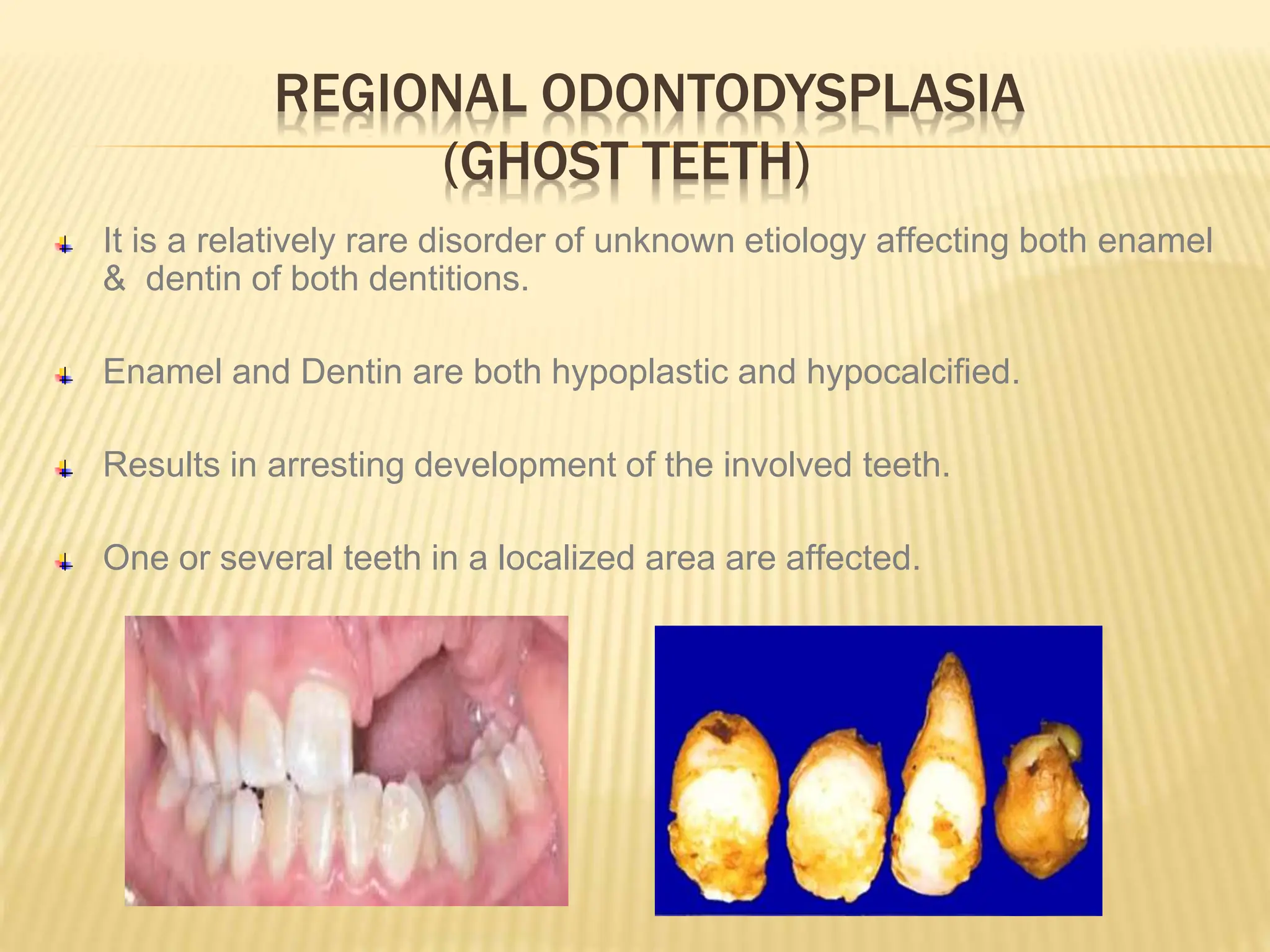 CONGENITAL AND DEVELOPMENTAL DEFECTS OF TEETH.pptx