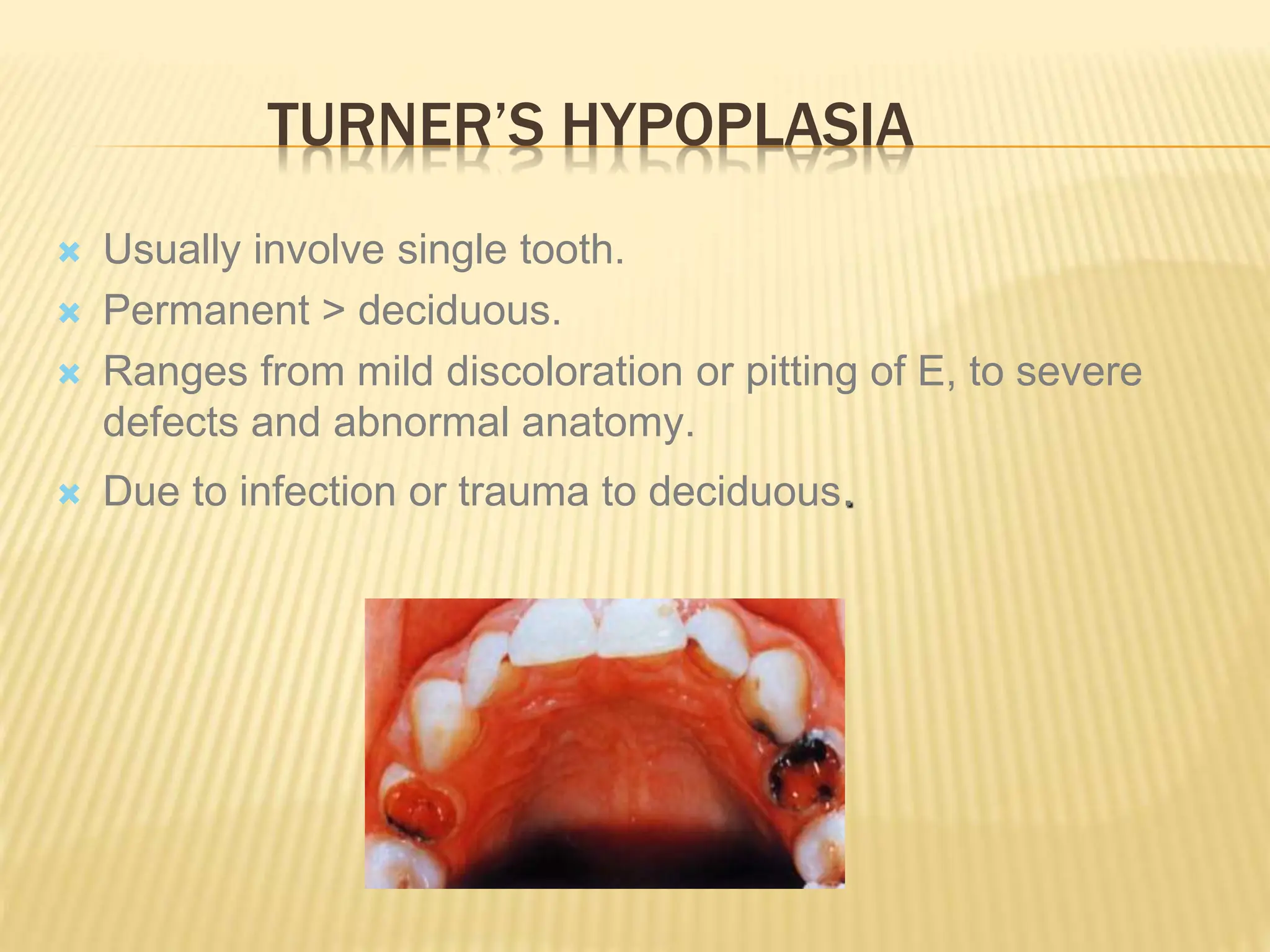 CONGENITAL AND DEVELOPMENTAL DEFECTS OF TEETH.pptx