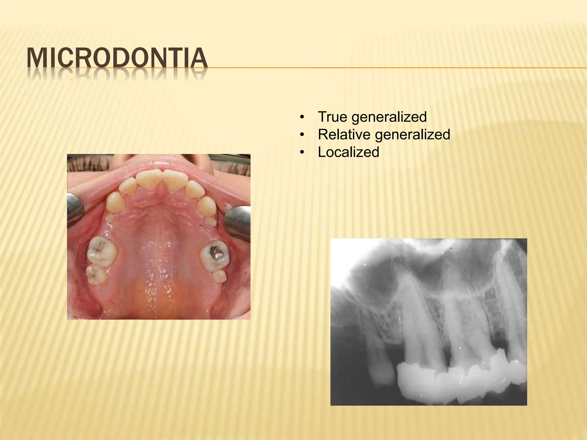 CONGENITAL AND DEVELOPMENTAL DEFECTS OF TEETH.pptx