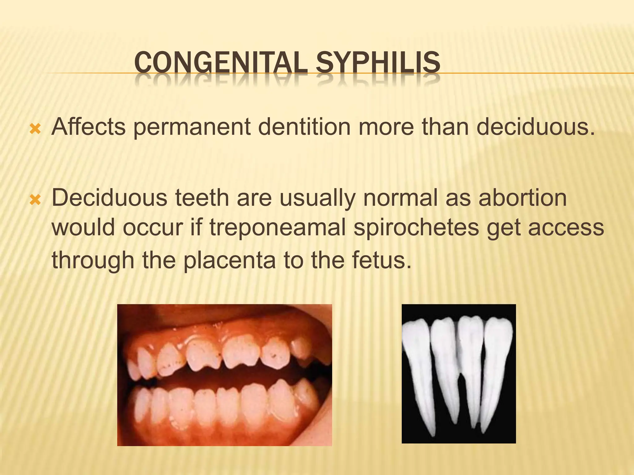 CONGENITAL AND DEVELOPMENTAL DEFECTS OF TEETH.pptx