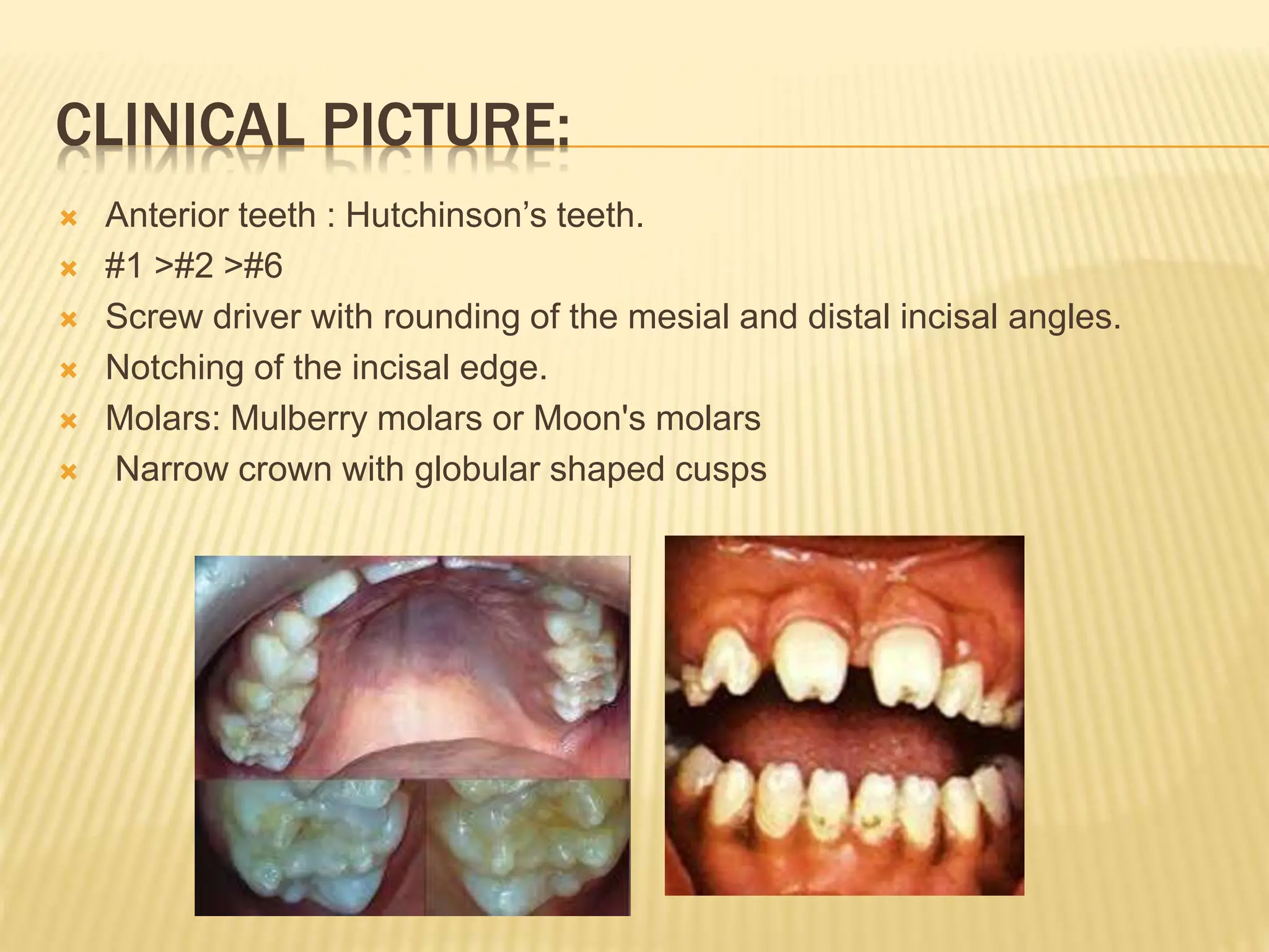 CONGENITAL AND DEVELOPMENTAL DEFECTS OF TEETH.pptx