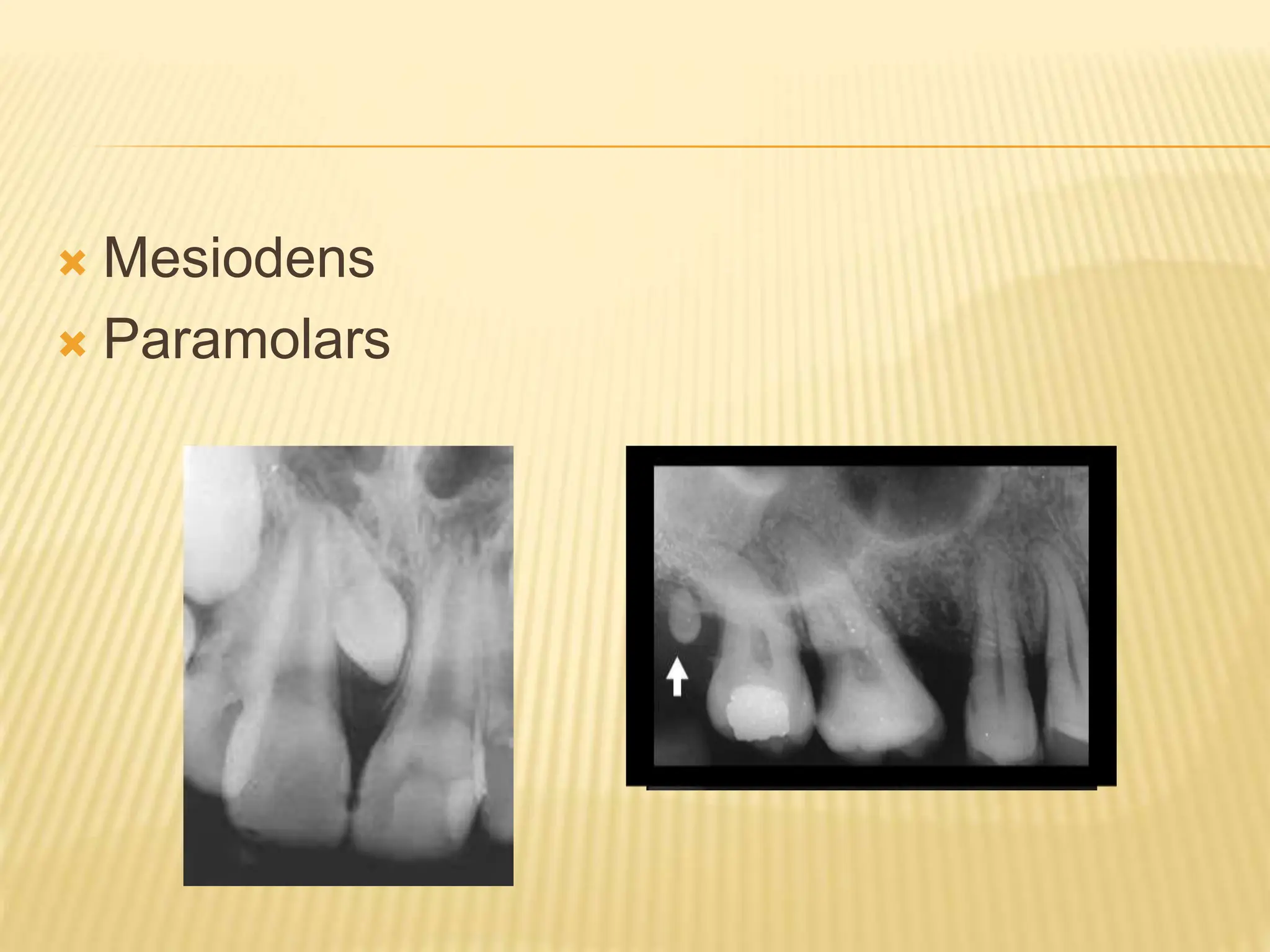 Congenital And Developmental Defects Of Teeth Pptx