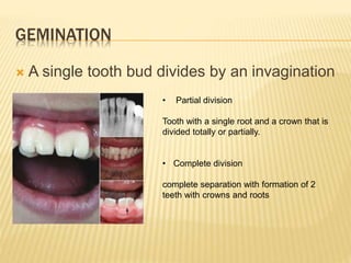 CONGENITAL AND DEVELOPMENTAL DEFECTS OF TEETH.pptx