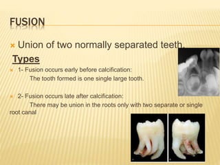 CONGENITAL AND DEVELOPMENTAL DEFECTS OF TEETH.pptx